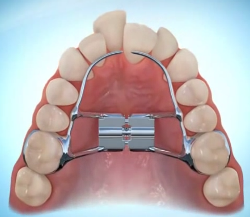Ορθοδοντική